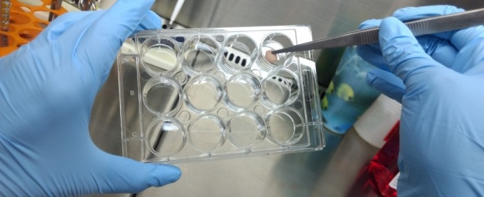 Cosmetics research firm uses discarded plastic surgery material instead ...